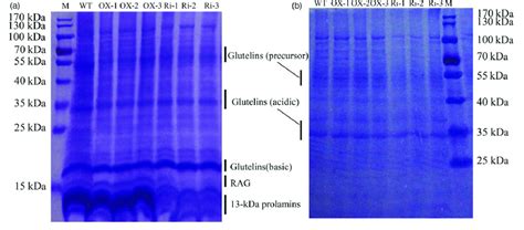 Seed Storage Proteins Level In Seeds Of WT And The Transgenic Lines Download Scientific