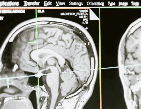 How We Helped Md Imaging Open Their New Radiology Practice Stanfield It