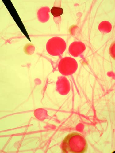 Fungi Flashcards Quizlet