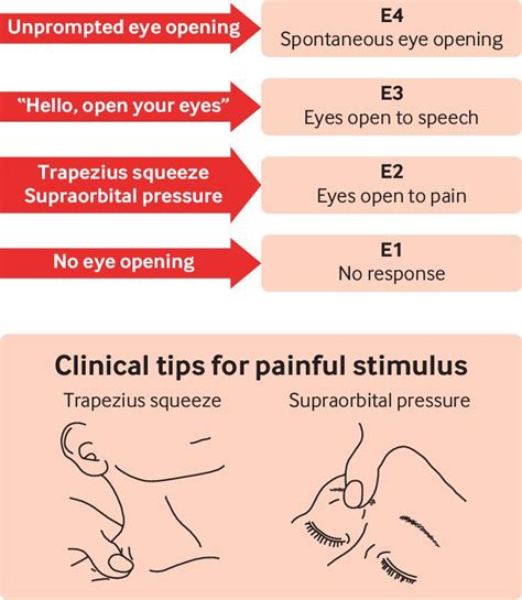 Glasgow Coma Scale Motor Response Explained Pdf Reddit