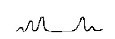 FPCC Questions Final Exam Flashcards Quizlet