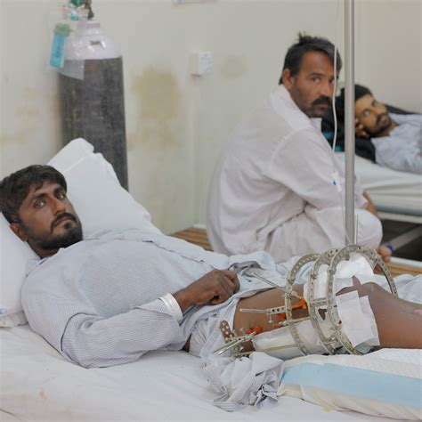 Open Reduction Internal Fixation Orif Indus Hospital And Health Network