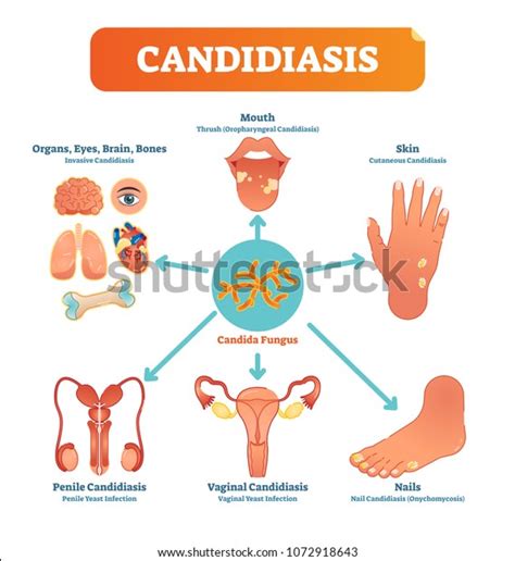 Medical 벡터 일러스트레이션 도표는 다양한 인체 스톡 벡터로열티 프리 1072918643 Shutterstock