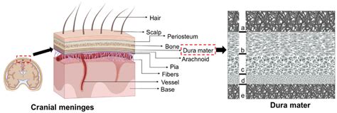A Schematic Representation Of The Cranial Meninges And Transverse