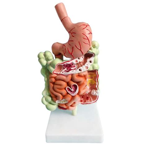 Buy Vklopdsh Human Digestive System Model Stomach Anatomy Intestine