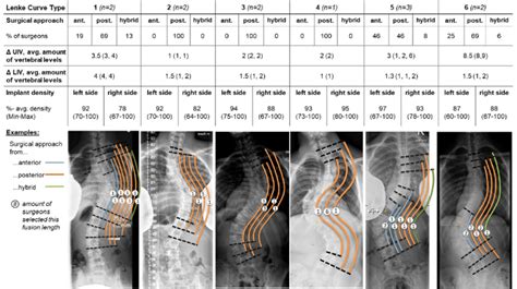 Surgical Strategies To Treat Adolescent Idiopathic Scoliosis Ais
