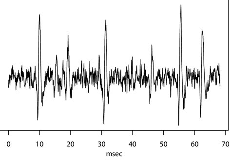 Extracellular Waveform Recorded From The Locust Schistocerca