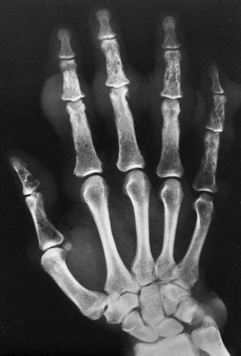 Miscellaneous Conditions Radiology Key