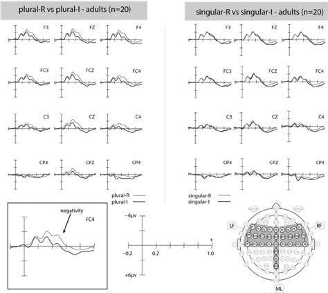 Adult ERP Effects At Selected Electrode Sites The Head On The Right Download Scientific