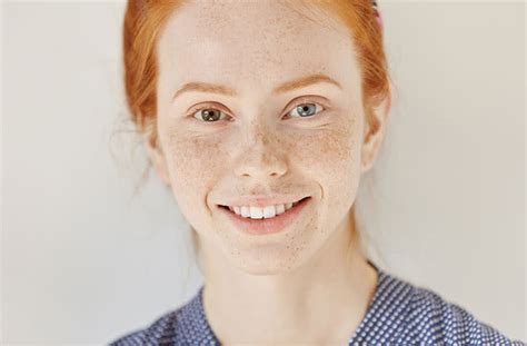 Different Colored Eyes Girl