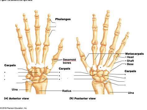 Metacarpals Labeled