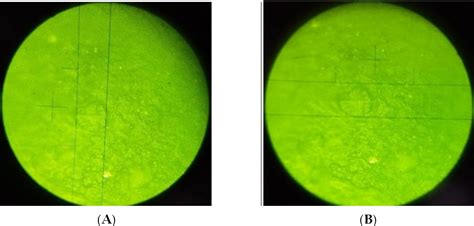 Figure 4 From The Microhardness And Surface Roughness Assessment Of Bulk Fill Resin Composites