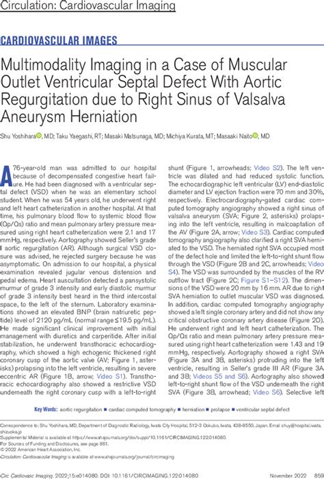 Multimodality Imaging In A Case Of Muscular Outlet Ventricular Septal Defect With Aortic
