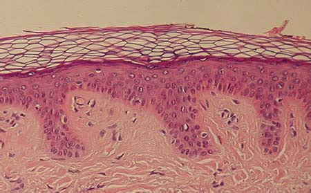 Keratin Structure Function Diseases Video Lesson Transcript Study Com