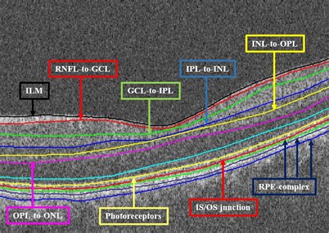 Definition Of Retinal Surfaces From Inner Retina To Its Outer
