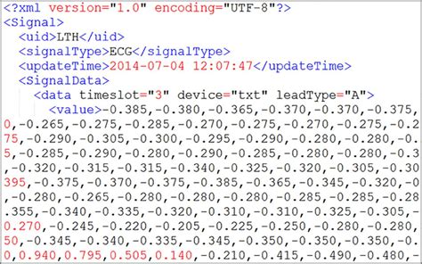 Result Of Ecg Data Stored As An Xml File Download Scientific Diagram