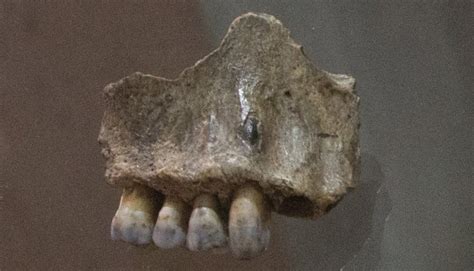 Jack Cuozzo Orthodontics In Six Days