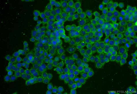 Tissue Factor Antibody 28005 1 Ap Proteintech