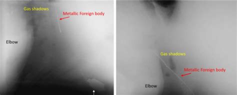 Ruminant Cardiology Flashcards Quizlet
