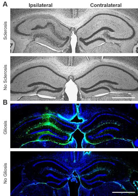 Histological Verification Of Successful Ihka Injection Targeting A