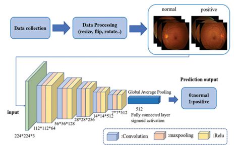 Ai精准预测“眼中风”风险，四川大学华西医院与鹰瞳airdoc联合研究在nature子刊发表 知乎