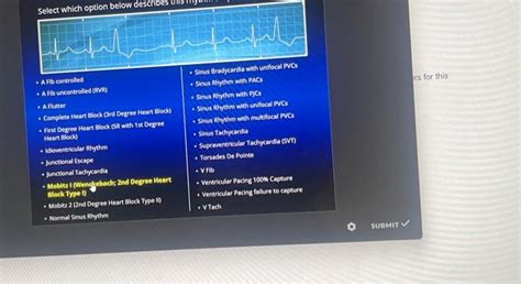 Solved Select Which Option Below Describes A Fib