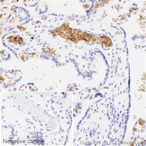 Biotin Anti Hemoglobin Subunit Alpha 抗体 [epr3608] Ab217074 Abcam