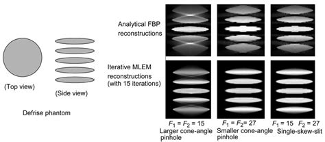 Defrise Phantom And Its Reconstructions With Analytical And Iterative Download Scientific