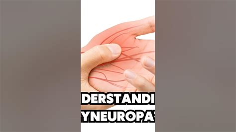 Understanding Polyneuropathy Causes Symptoms And Treatment Youtube