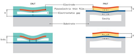 How Mems Ultrasound Imaging Became Ultra Small Ieee Spectrum
