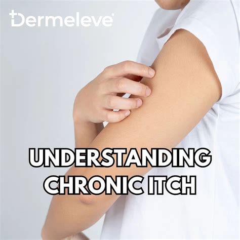 Atopic Dermatitis Ad And Chronic Itch Are More Than Just Skin