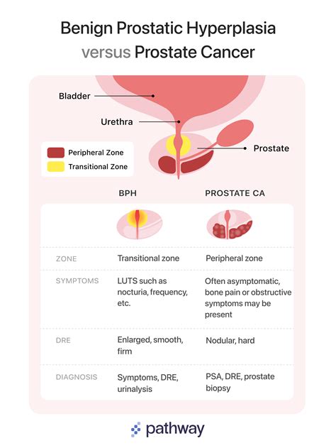 Complete List Of Symptoms For Bph