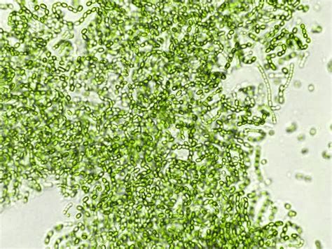 프로바이오틱스 사진 Unsplash에서 무료 이미지 다운로드