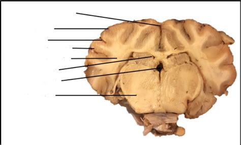 Sheep Brain Diagram Quizlet