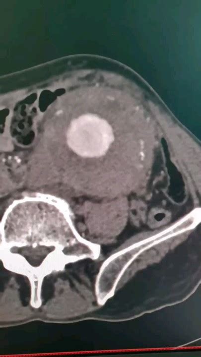 Video Imen Ganzoui On Linkedin 🌀 Video Imen Ganzoui On Linkedin 🌀