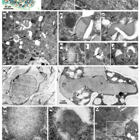 Immuno Gold Electron Micrographs Showing The Subcellular Localization