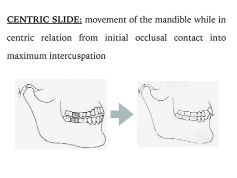 Centric Relation Seminar Pdf Dental Health Diseases And Conditions