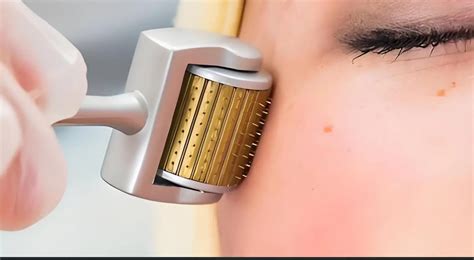 Medical Grade Derma Rollers What Is The Difference Xdermaroller