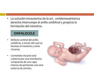 Gastrosquisis Y Onfalocele Pptx