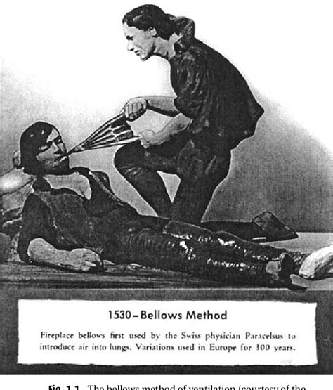 Figure 11 From A History Of Cardiopulmonary Resuscitation Semantic