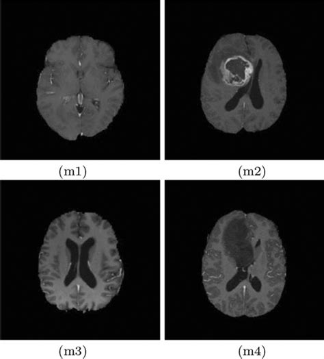 Samples Images From Brats 2013 Dataset Download Scientific Diagram