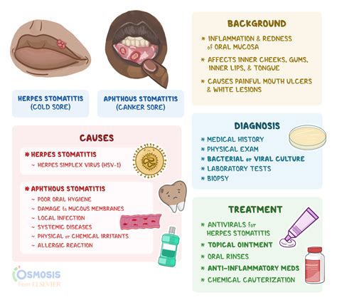 Stomatitis What Is It Causes Signs And More Osmosis