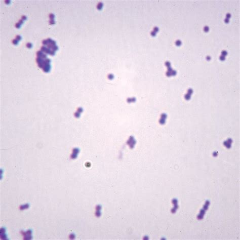 Slide Staphylococcus Aureus Wm Each Vitta Scientific