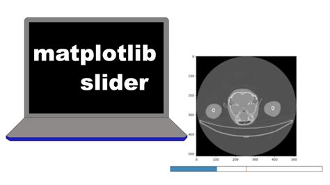 Pythonでレントゲンのdicom画像を開く｜医療のためのpythonプログラミング