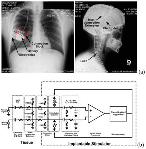 A General Device Architecture For A Bi Directional Neural Interface