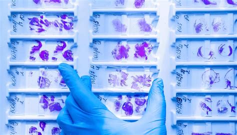 Anonymous Donors Get To See How Their Tissue Is Used Futurity