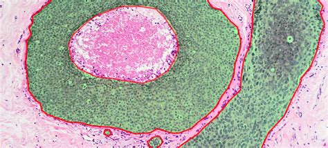 Microscopic Image Segmentation And Pathology Recognition