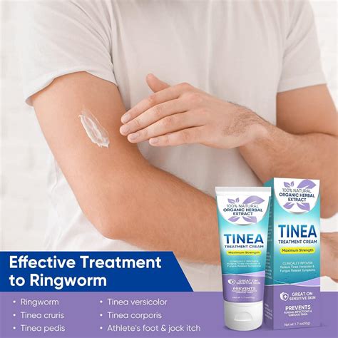 Tinea Versicolor Natural Skin Cream Effective Treatment For All Skin