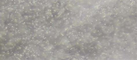 Significant Sperm Count Decline In Western Men Says Study MPR