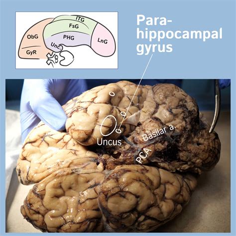 Neuroanatomy Glossary Parahippocampal Gyrus Ditki Medical And Biological Sciences